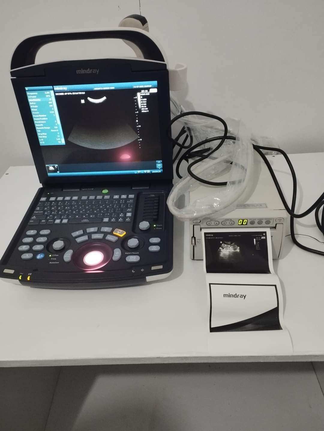 Mindray DP-10 portable ultrasound system – nnonya.com